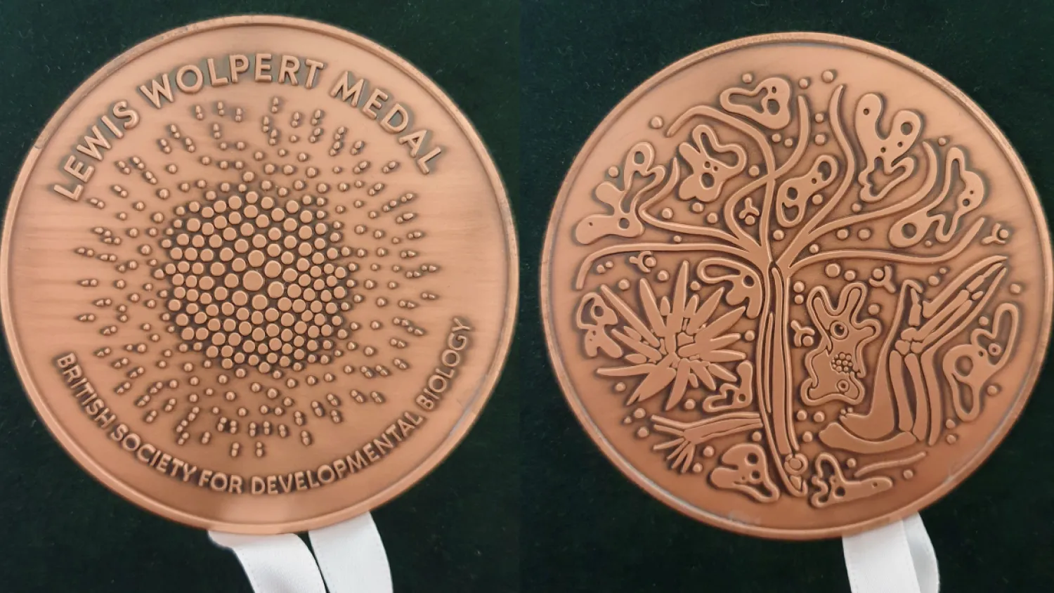 Sally Lowell receives Wolpert Medal | Biology