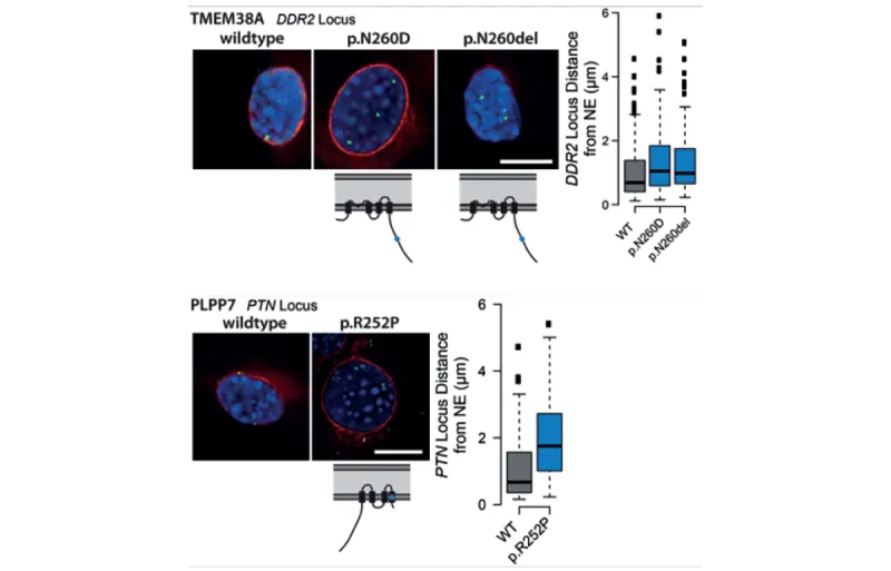 Research | Eric Schirmer Lab | Biology